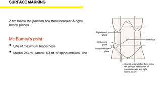 Acute Appendicitis | PPTX