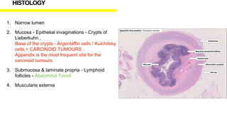 Acute Appendicitis | PPTX | Digestive Disorders | Diseases and Conditions
