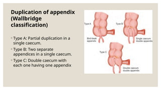 appendix and its diseases in detail for surgery | PPTX