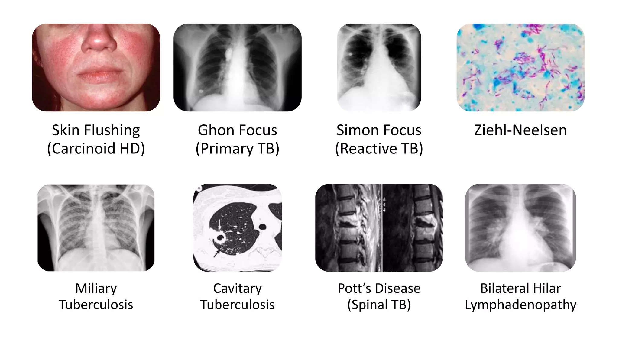 USMLE Step 1 General review - Appendix | PPTX