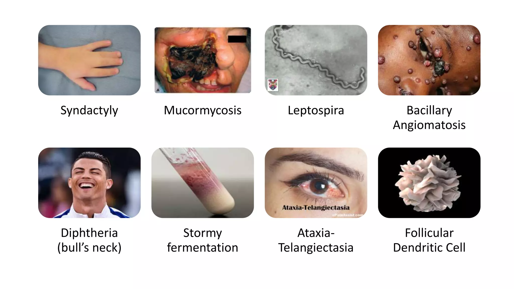 USMLE Step 1 General review - Appendix | PPTX