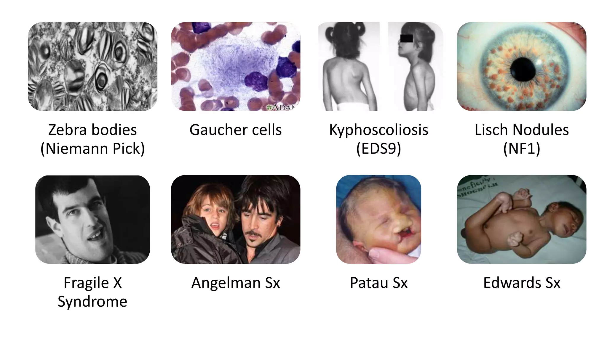 USMLE Step 1 General review - Appendix | PPTX