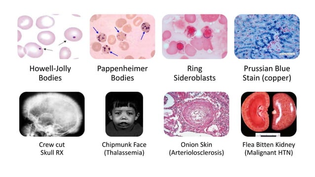 USMLE Step 1 General review - Appendix | PPTX