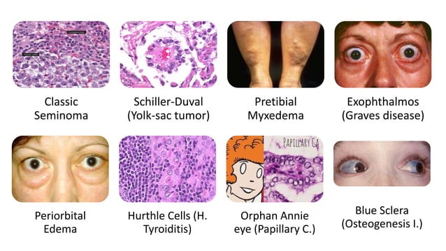 USMLE Step 1 General review - Appendix | PPTX