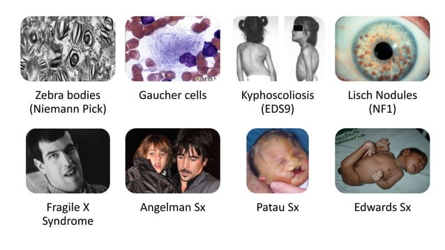 USMLE Step 1 General review - Appendix | PPTX