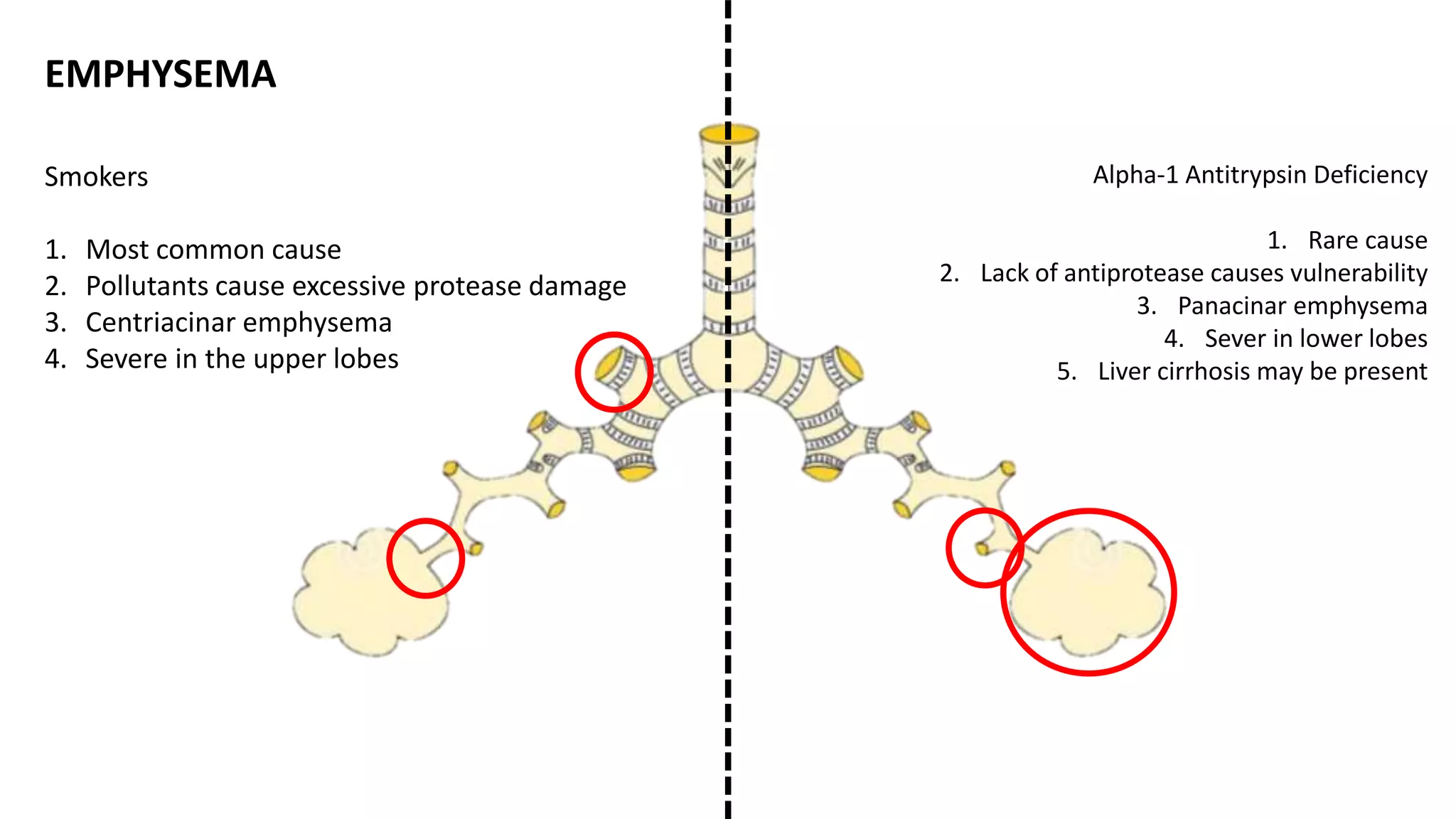 USMLE Step 1 Pathology review PART 2 | PPTX