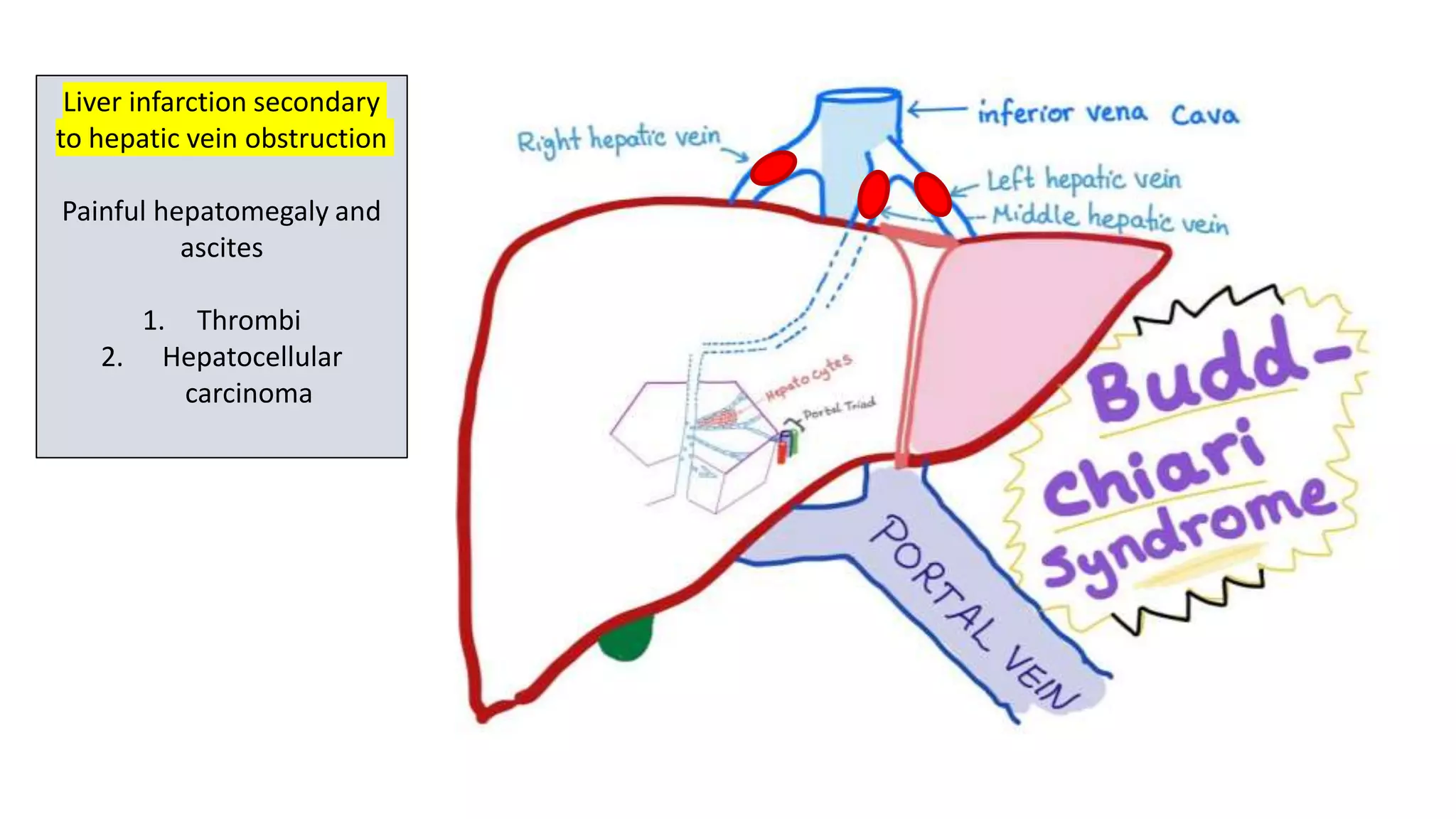 USMLE Step 1 Pathology review PART 2 | PPT