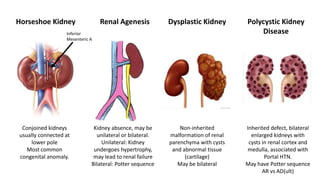 USMLE Step 1 Pathology review PART 2 | PPTX