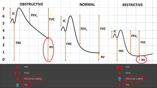 USMLE Step 1 Physiology | PPTX | Lung and Respiratory Health | Diseases ...
