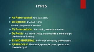 Anatomy of appendix | PPTX