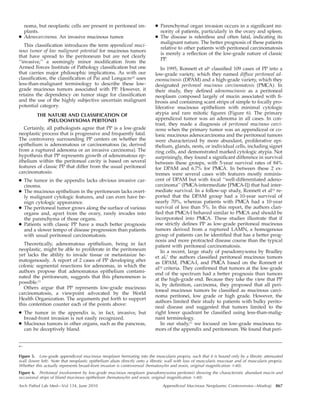 appendix mucinous tumores.pdf jkljkljkljlkjkljlkjlk | PDF
