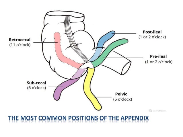 Appendix ,Colon, Rectums ana Anal Canal PRESENTATION POWERPOINT.pptx