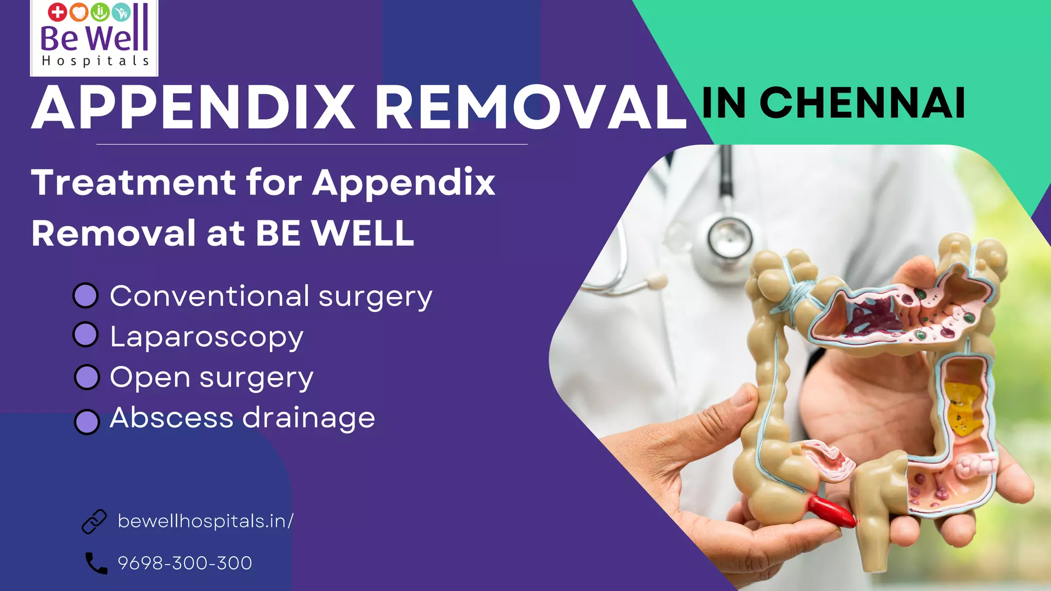 Appendix Removal in Chennai.pdf