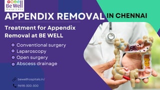 Appendix Removal in Chennai.pdf