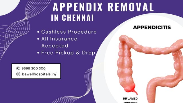 Appendix Removal in Chennai.pdf | Healthcare Industry | Industries