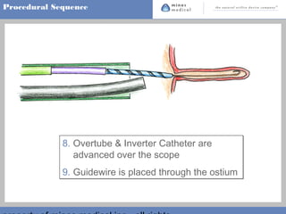 Appendoectomy | PPT | Surgery | Medical Health