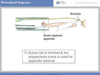 Appendoectomy | PPT | Surgery | Medical Health