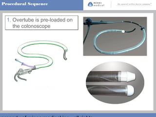 Appendoectomy | PPT | Surgery | Medical Health