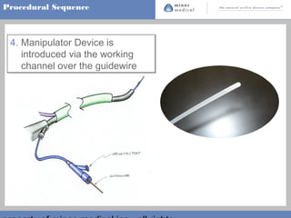 Appendoectomy | PPT | Surgery | Medical Health
