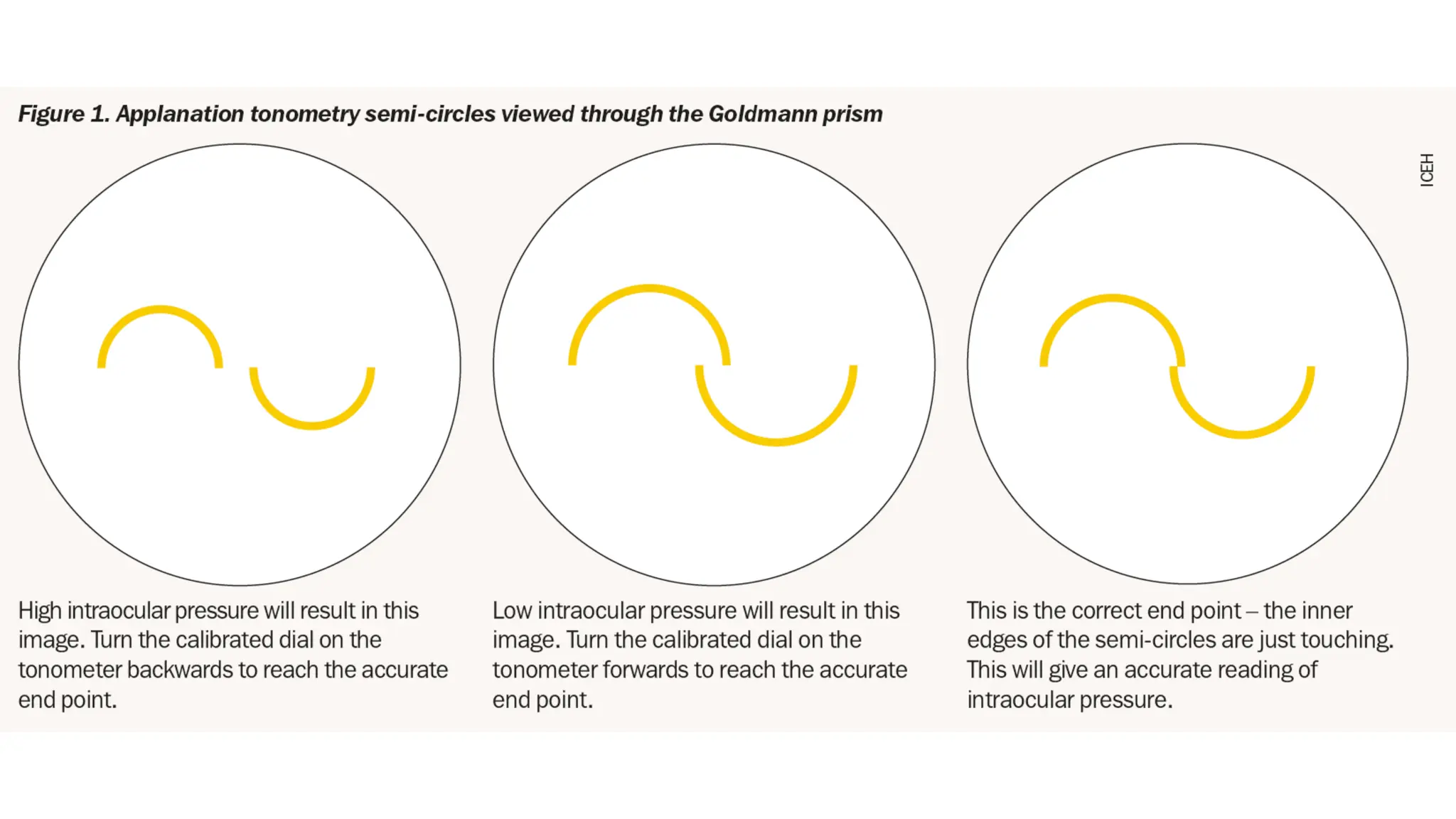 applanation tonometer ophthal.pptx