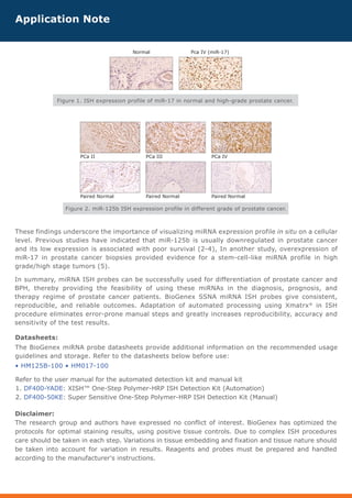 prostate cancer classification - BioGenex | PDF