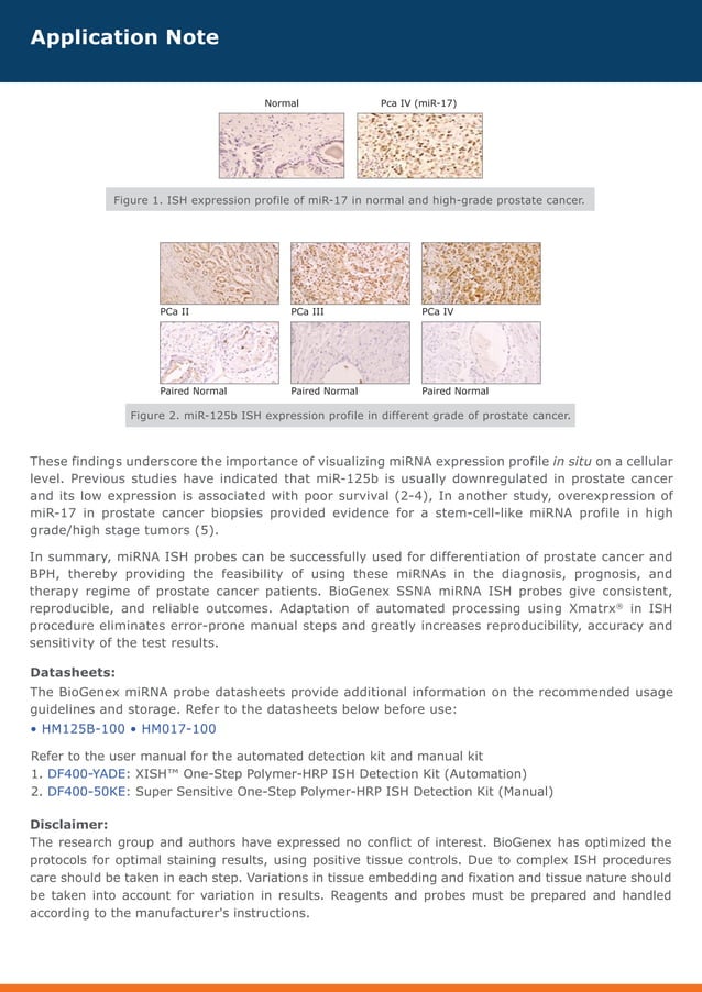 prostate cancer classification - BioGenex | PDF