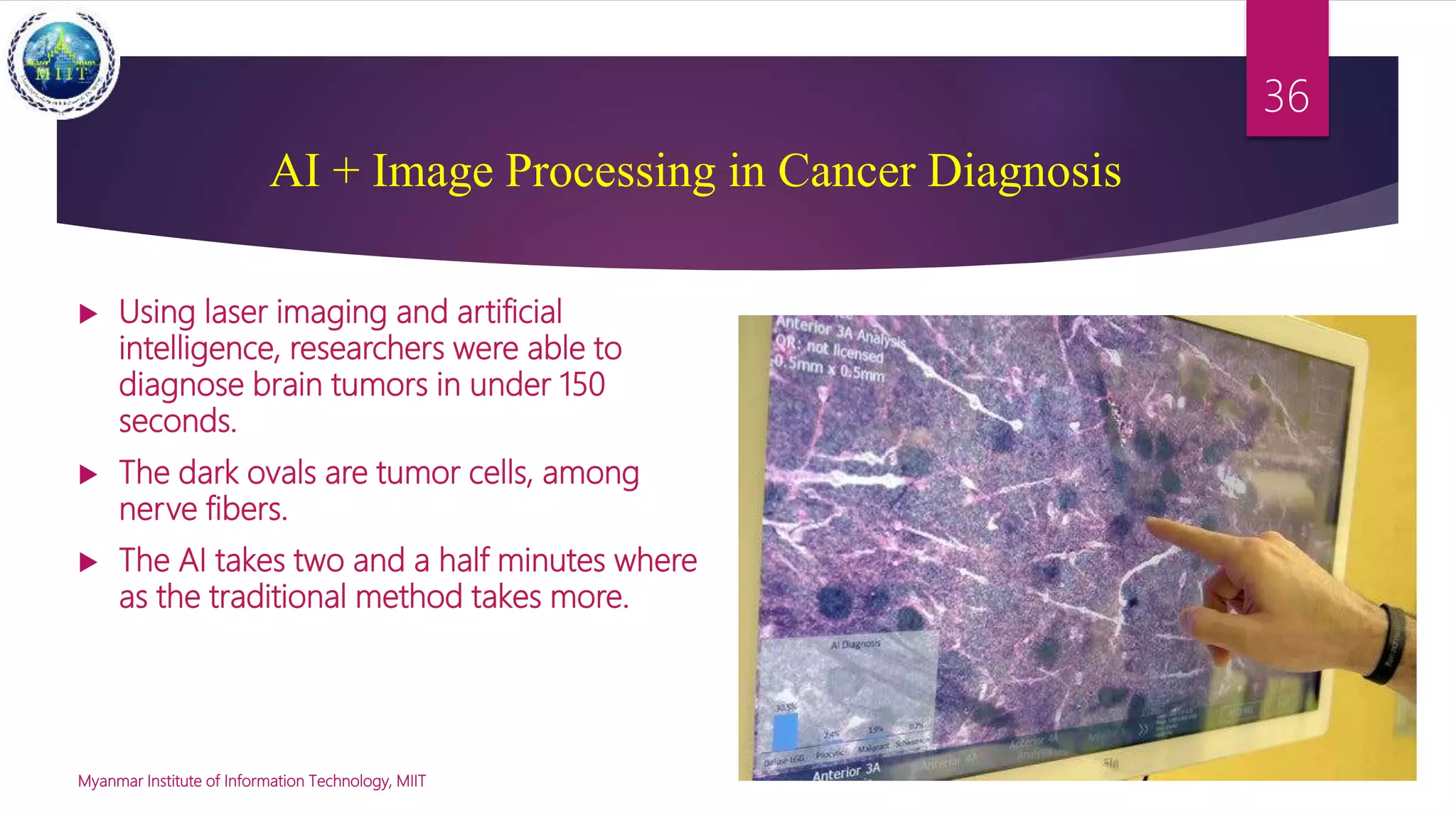 Application Of Image Segmentation In Brain Tumor Detection Pptx