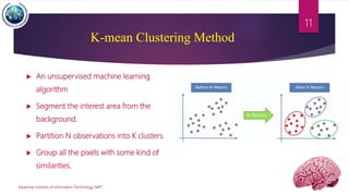 Application of-image-segmentation-in-brain-tumor-detection | PPTX