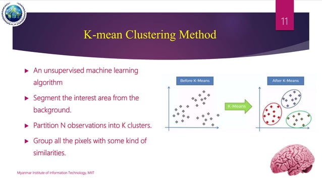 Application Of Image Segmentation In Brain Tumor Detection Ppt