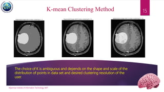 Application of-image-segmentation-in-brain-tumor-detection | PPTX