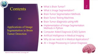 Application of-image-segmentation-in-brain-tumor-detection | PPTX