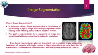 Application of-image-segmentation-in-brain-tumor-detection | PPTX