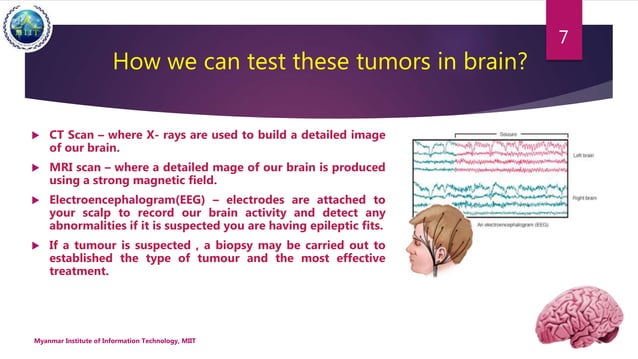 Application Of Image Segmentation In Brain Tumor Detection Pptx Brain And Nervous System
