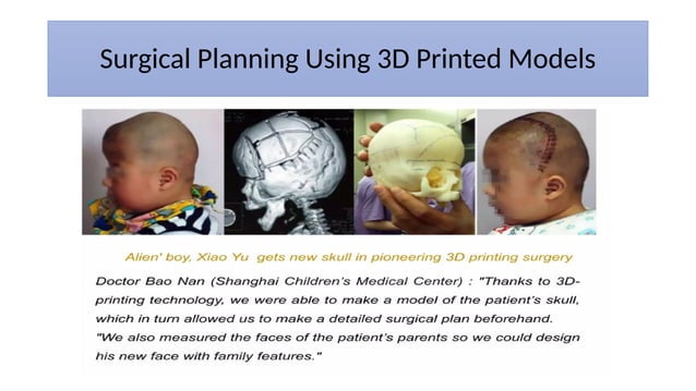 APPLICATION OF 3D PRINTING IN ONCOLOGY_isha.pptx