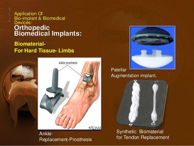 Application of bio implant & biomedical devices-recent advancement a…