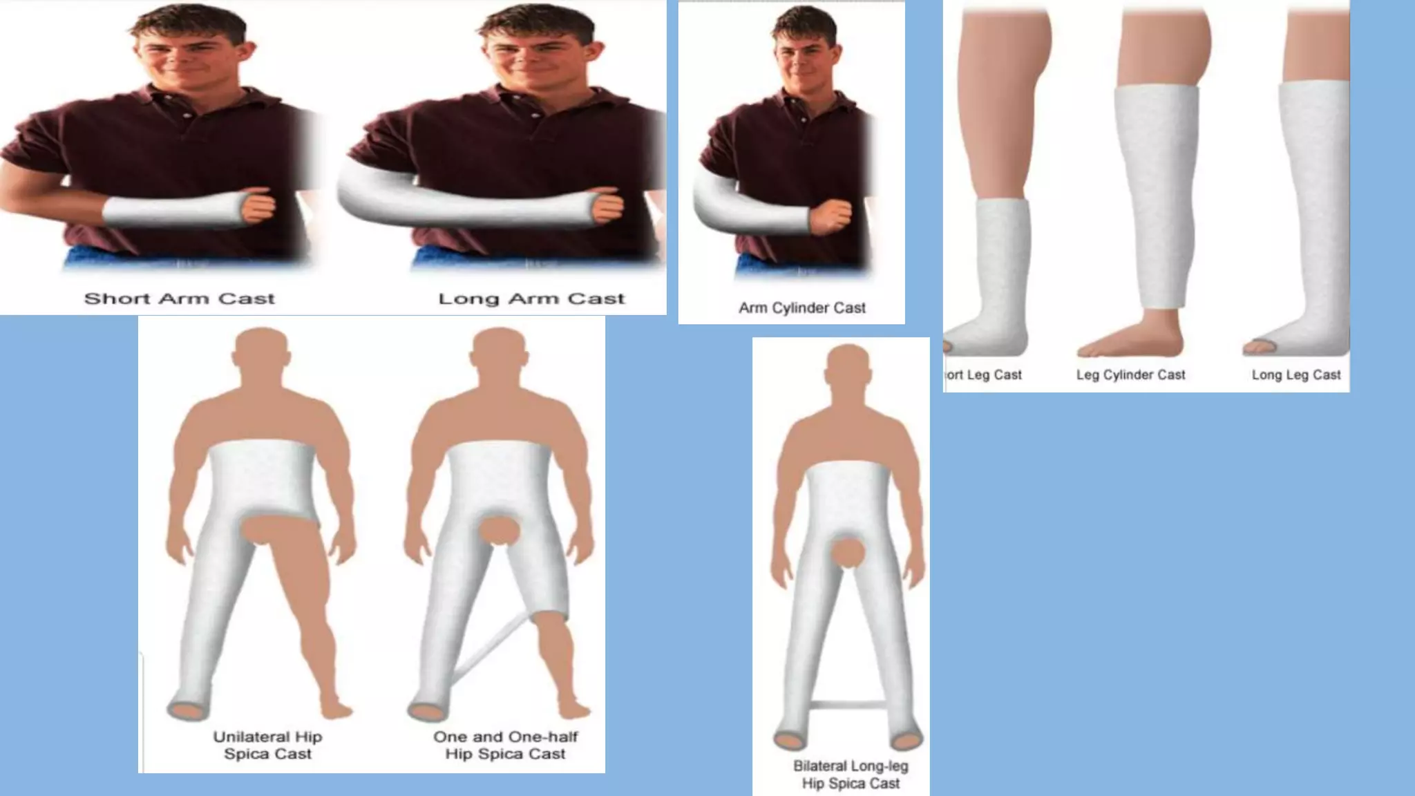 Application of cast | PPTX