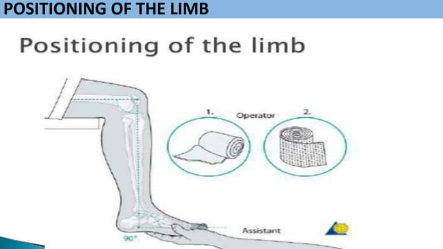 Application of cast | PPTX | Death, Injury, or Military Conflict ...
