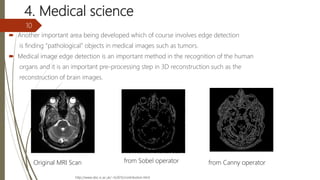 Application of edge detection | PPTX