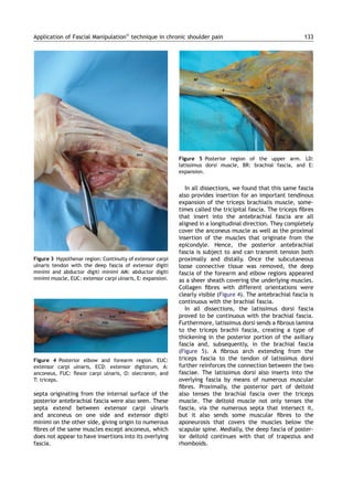 Application of fascial manipulation technique in chronic shoulder pain ...