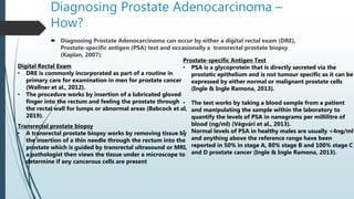 Application of immunotherapy therapeutics in prostate adenocarcinoma ...