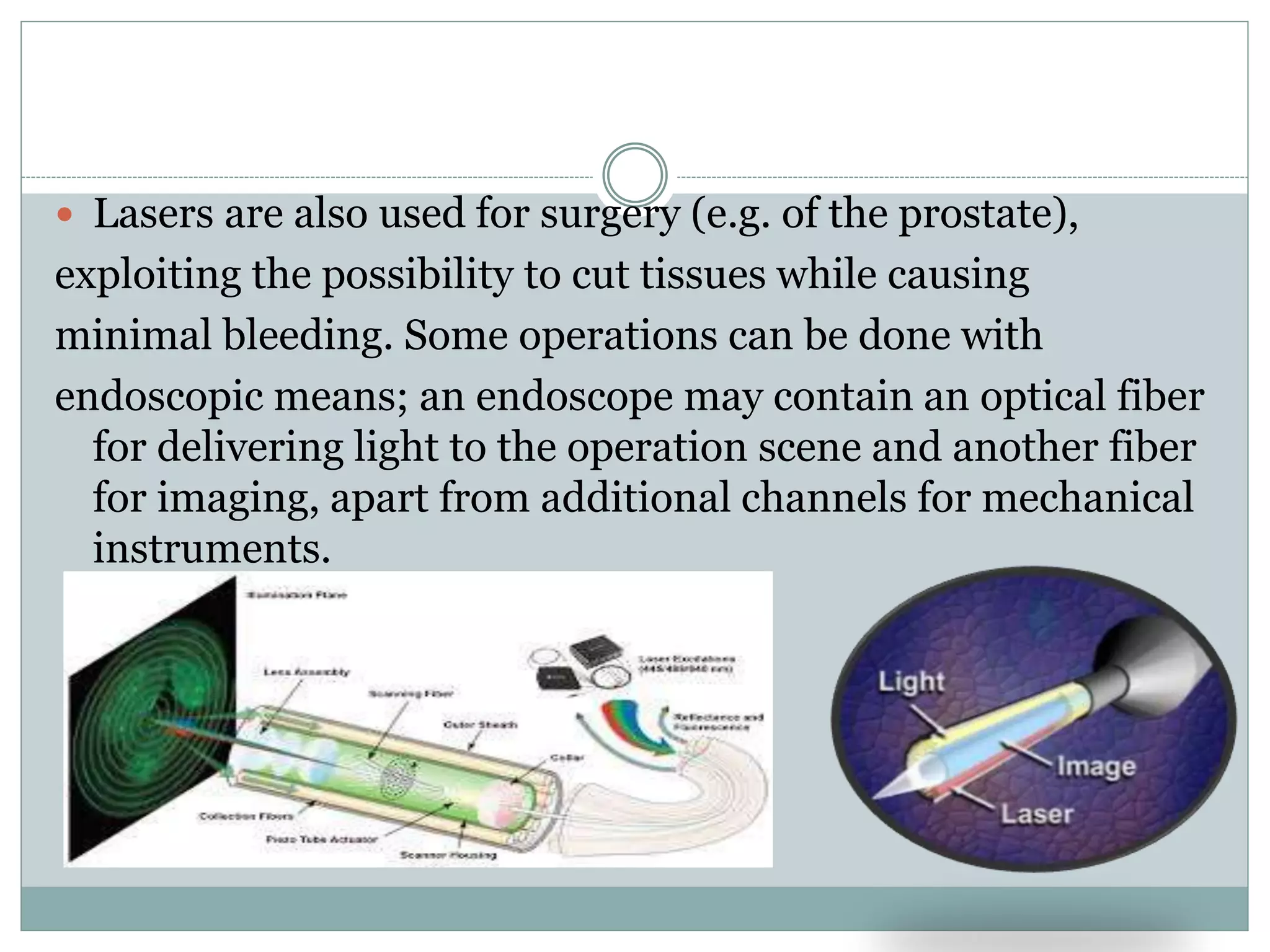 Application of laser by me | PPT