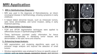 APPLICATION OF MRI with reference MI.pptx