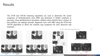 APPLICATION OF MRI with reference MI.pptx