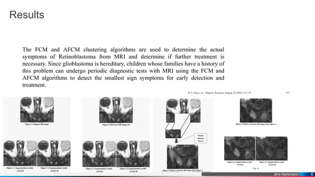 APPLICATION OF MRI with reference MI.pptx