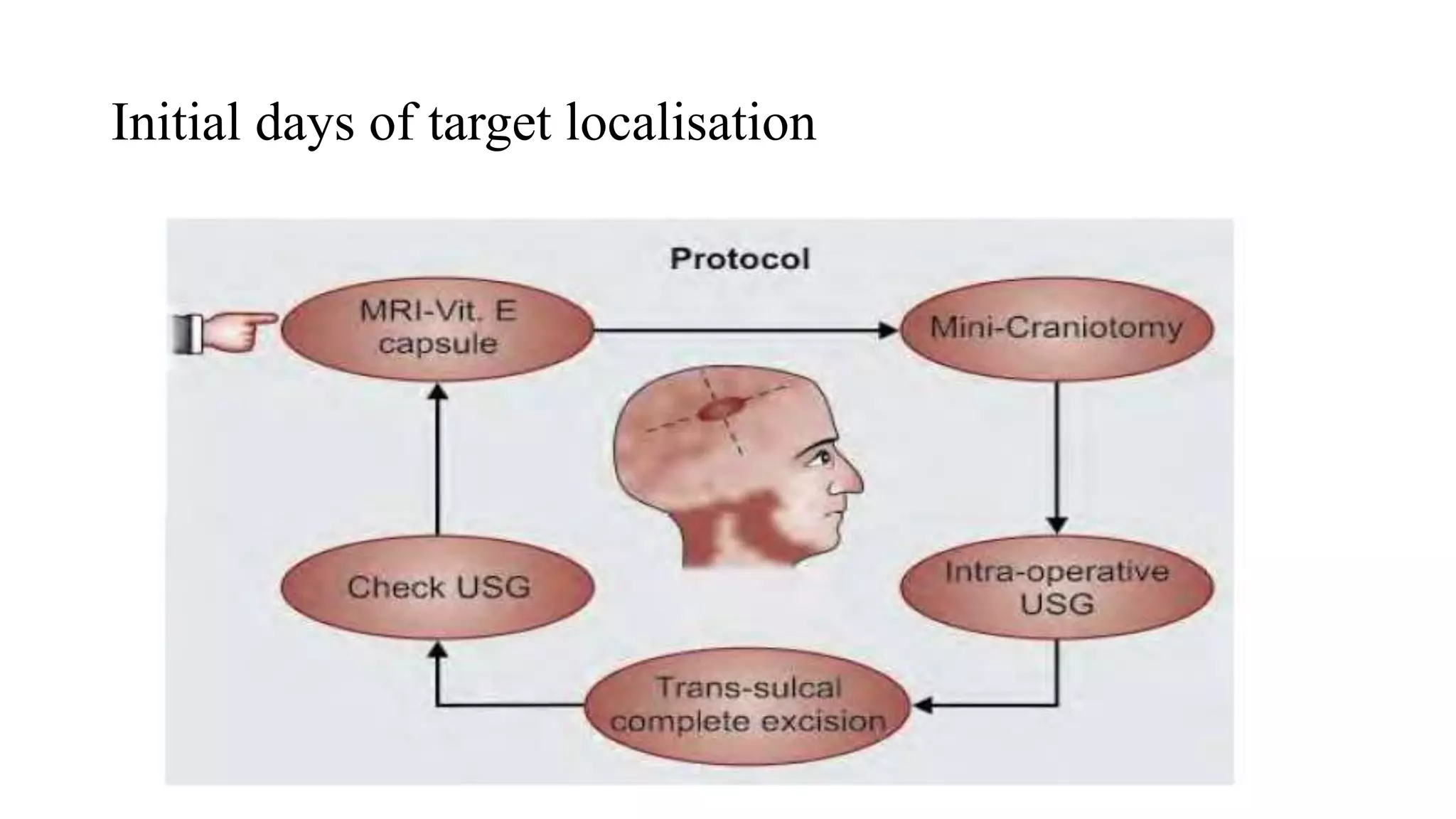 Application of Neuronavigation in Brain Surgery | PPTX