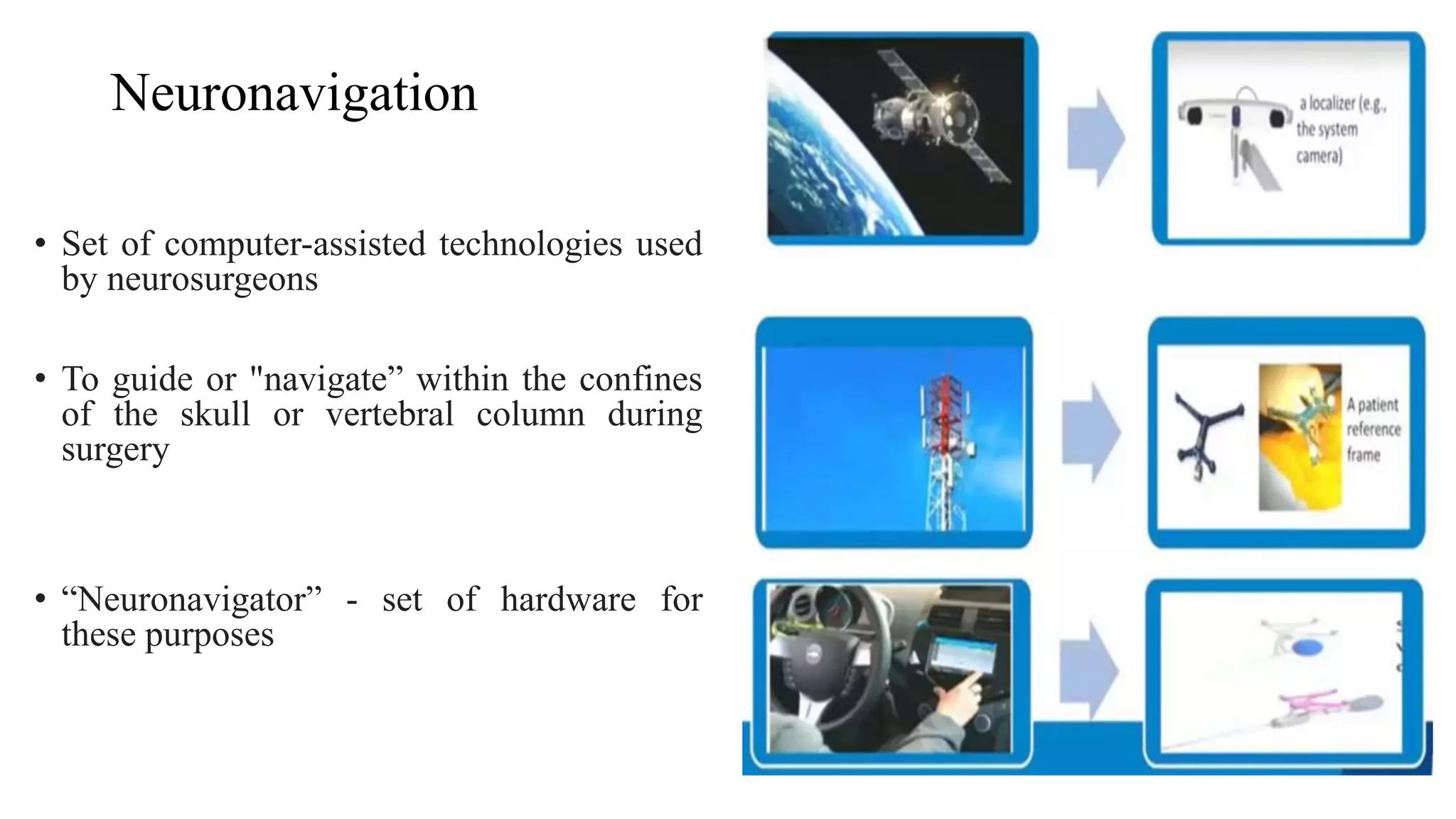 Application of Neuronavigation in Brain Surgery | PPTX