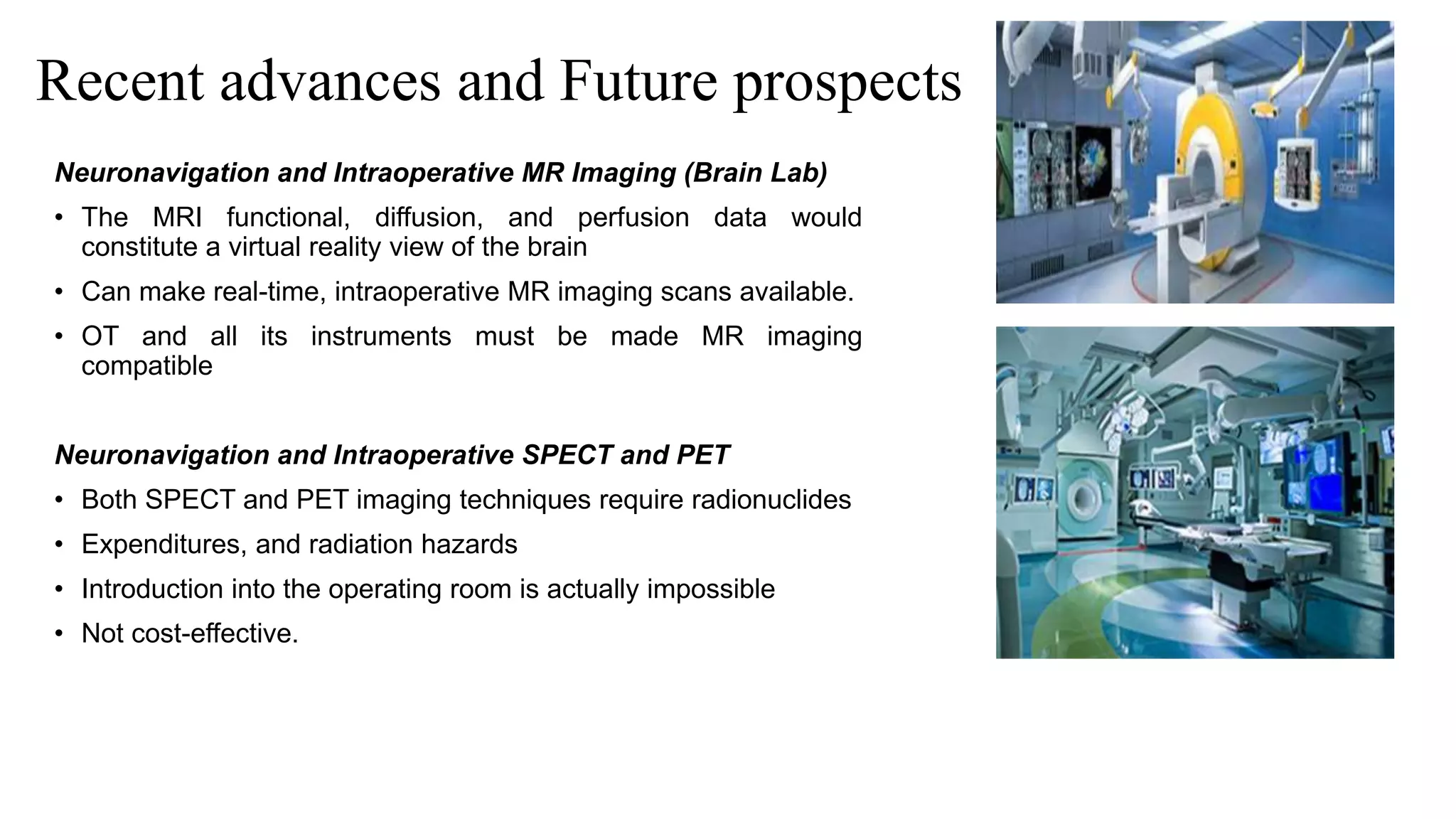 Application of Neuronavigation in Brain Surgery | PPTX