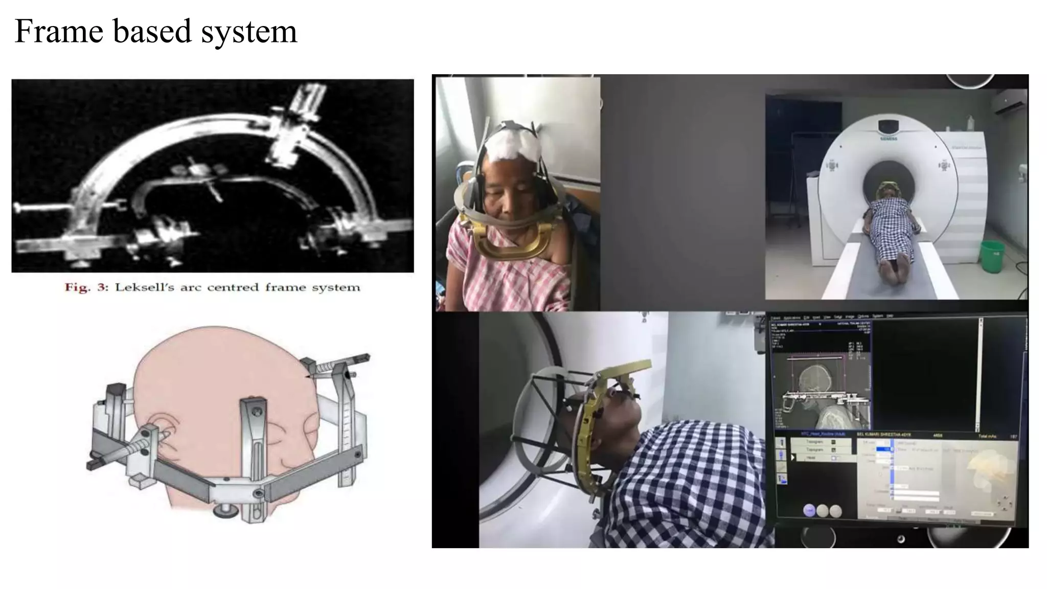 Application of Neuronavigation in Brain Surgery | PPTX