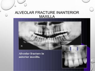 Application of opg in orthodontics | PPTX