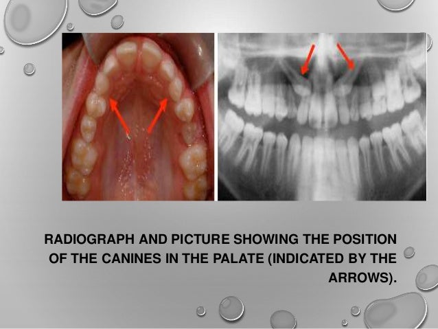 Application of opg in orthodontics